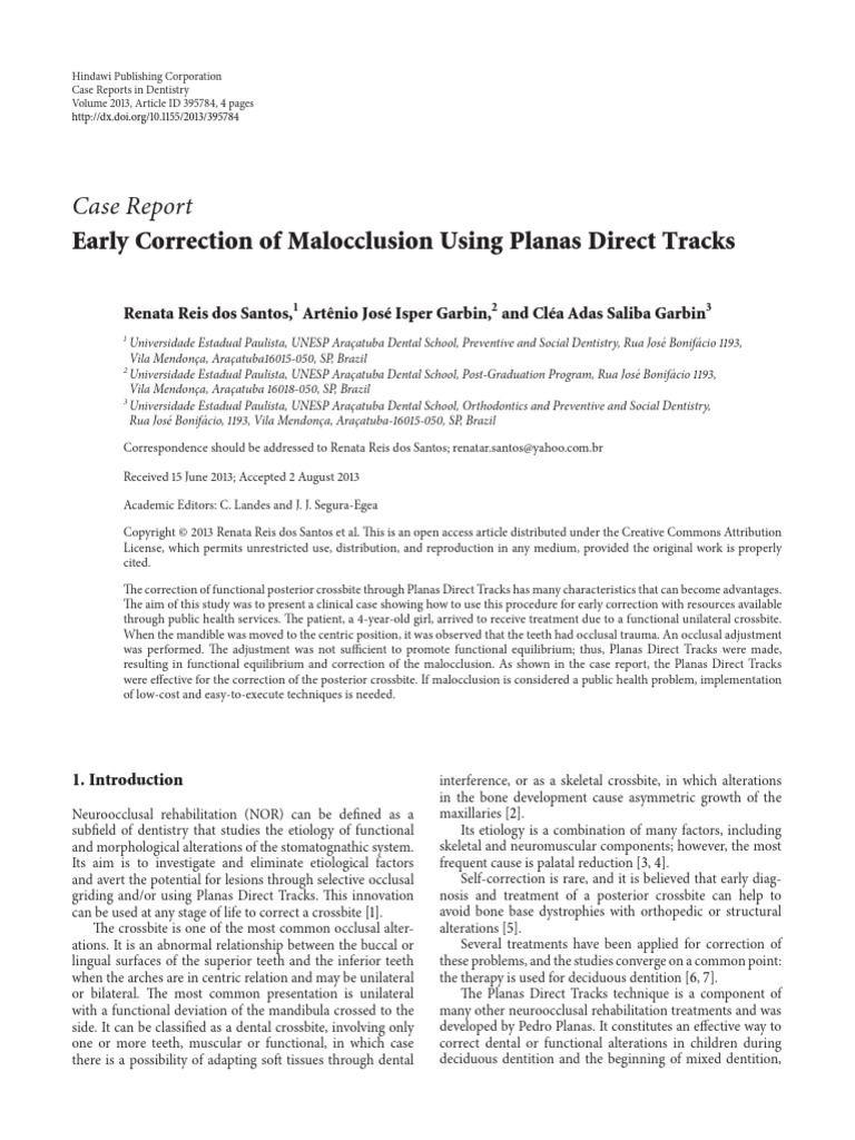 Early Correctionof Malocclusion Using Planas Direct Tracks | PDF ...
