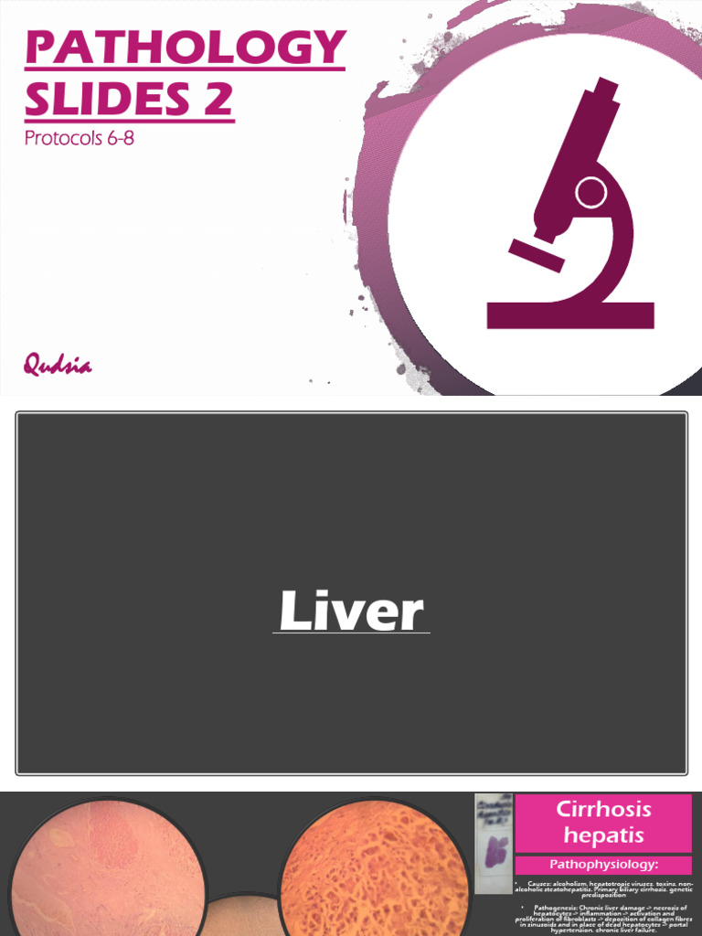 Pathology Slides by Organ 2 | PDF | Liver | Cirrhosis