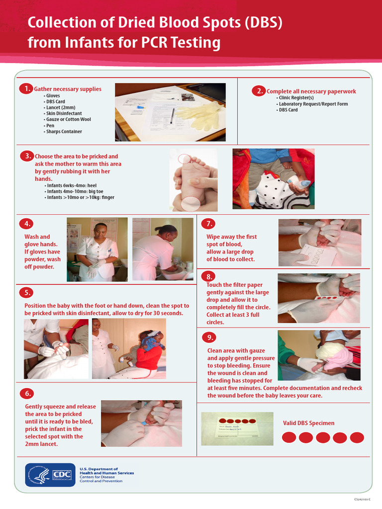 Collection of Dried Blood Spots - DBS - Clinic Job Aid | PDF | Medical ...