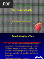 SCST - ECG Reporting Standards and Guidance (2023) | PDF ...