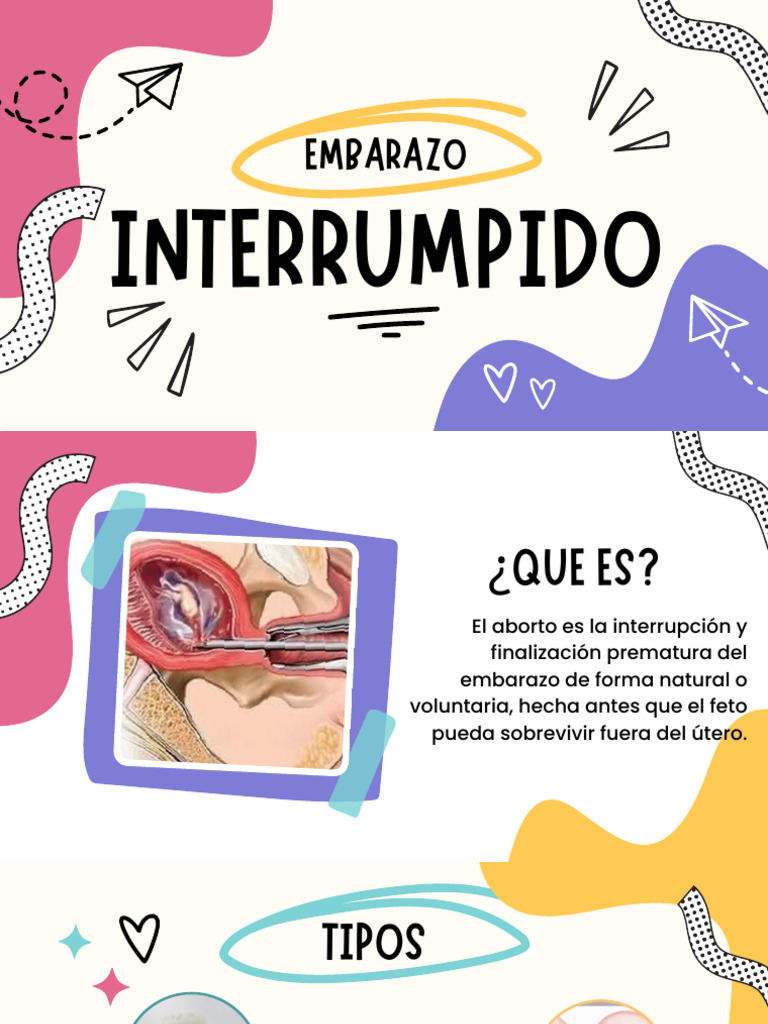 Embarazo Interrumpido | PDF