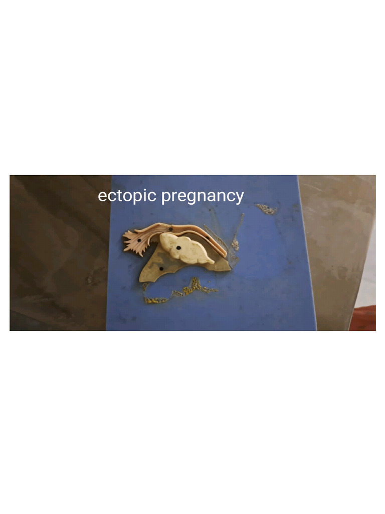 All Embryological Models | PDF