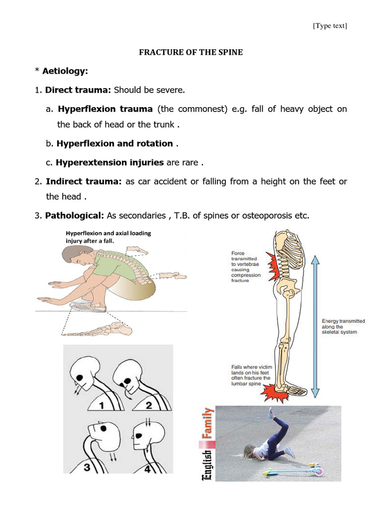 Spine Fracture Management Guide | PDF | Vertebral Column | Spinal Cord
