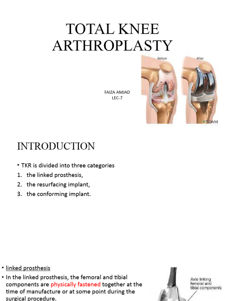 Total Knee Arthroplasty | PDF | Thorax | Knee