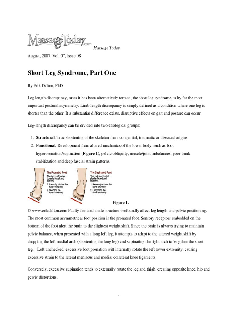 Short Leg Syndrome PART 1 | PDF