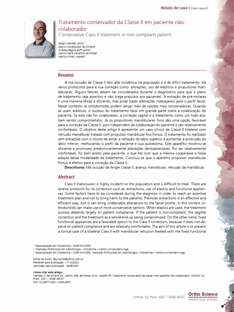Tratamento Classe II com Forsus em Paciente Não-Colaborador | PDF ...