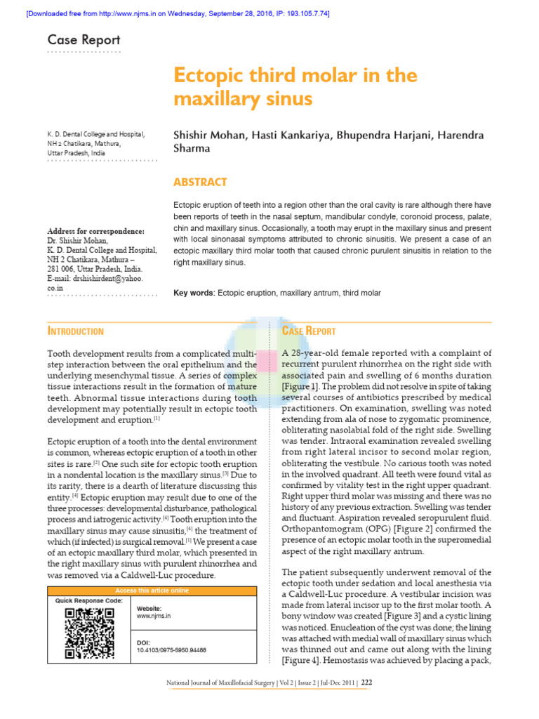 Ectopic Third Molar in The Maxillary Sinus | PDF