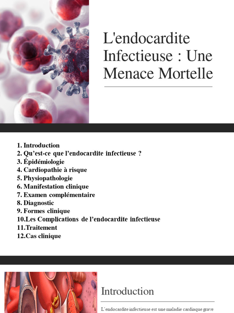 Endocardite Infectieuse 1 | PDF | Sciences et mathématiques