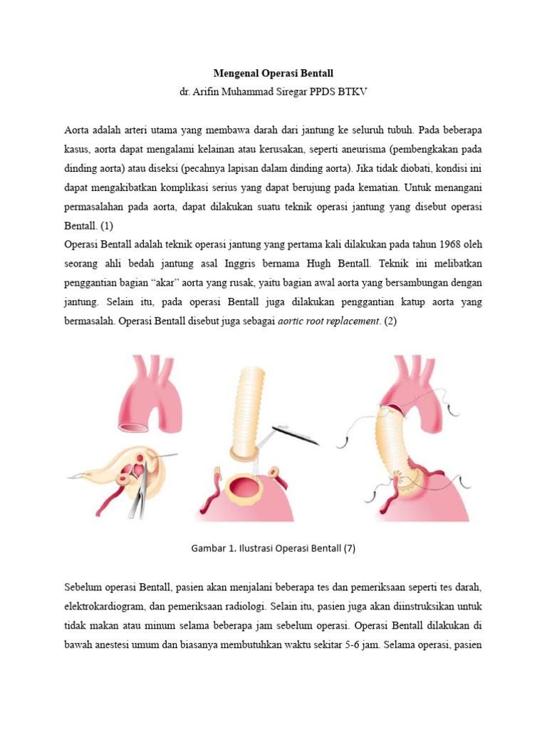 Operasi Bentall: Prosedur dan Pemulihan | PDF