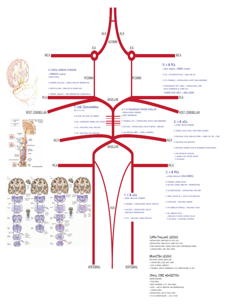 Brainstem Stroke Syndromes Guide | PDF | Nervous System | Neuroscience