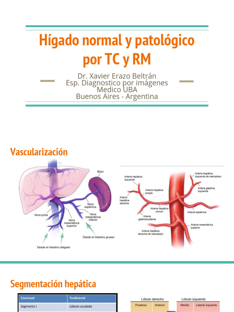 Hígado Normal y Patológico Por TC y RM | PDF | Cirrosis | Abdomen