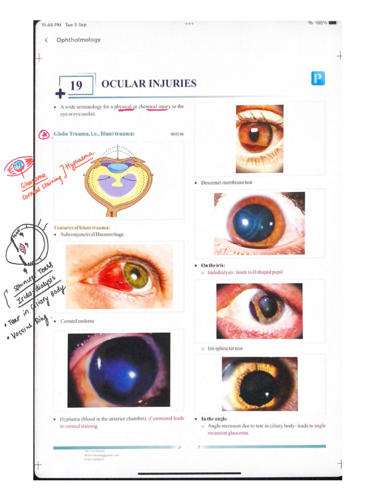Ocular Injuries | PDF