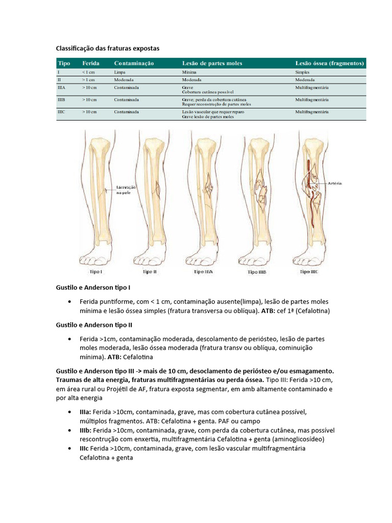 Classificação Das Fraturas Expostas | PDF
