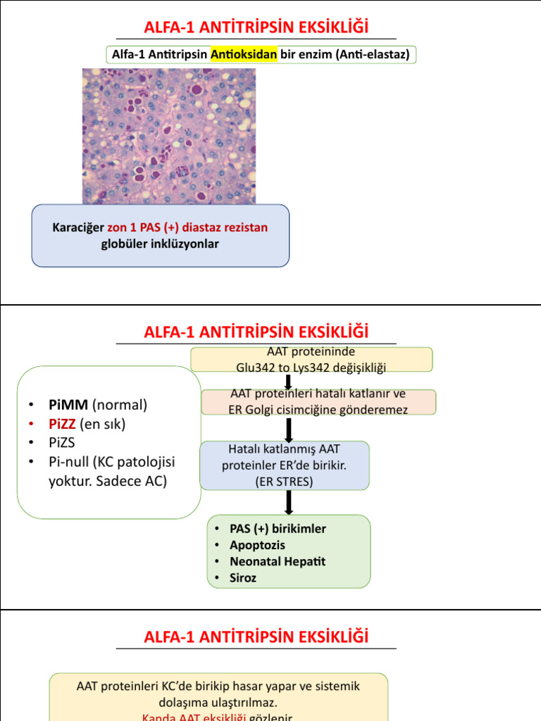 Alfa 1 Antitripsin Eksikliği Detaylı Anlatım YouTube Kanalımda | PDF