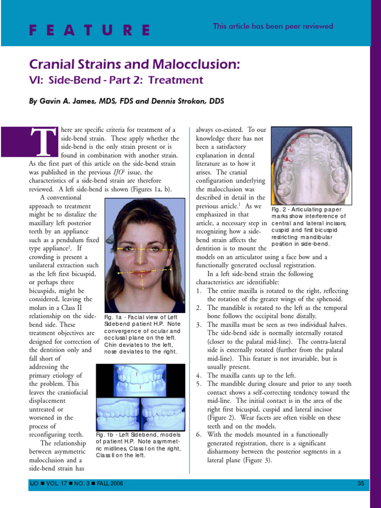Cranial Strains and Malocclusion VI Side Bend Part 2 Treatment | PDF