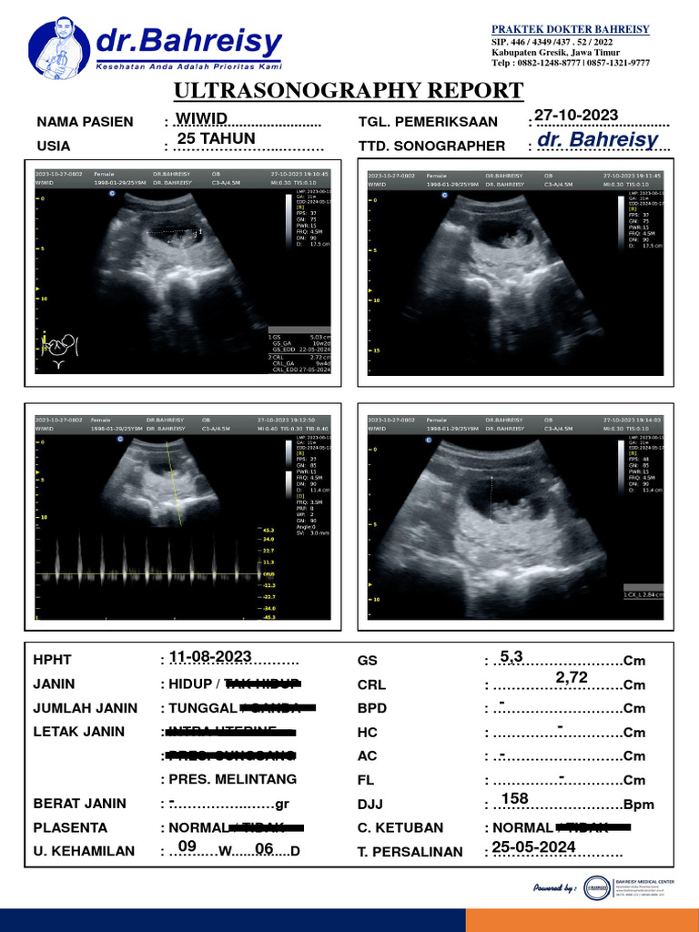 Laporan USG Kehamilan Gresik | PDF