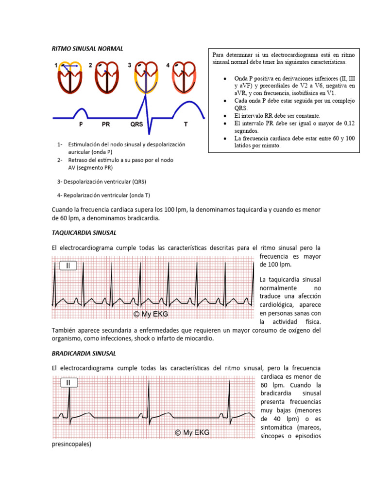 Ritmo Electrocardiograma | PDF