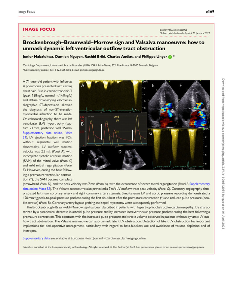 Brockenbrough-Braunwald-Morrow Sign and Valsalva Manoeuvre How To ...