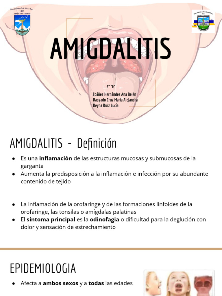 Amigdalitis | PDF | Ronquidos | Diagnostico medico
