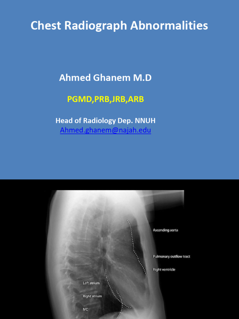 002 Chest Radiograph Abnormalities-1 | PDF | Lung | Pneumonia
