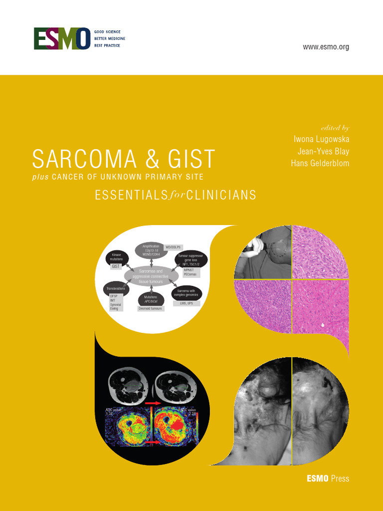 ESMO Sarcoma GIST and CUP Essentials For Clinicians | PDF | Sarcoma ...