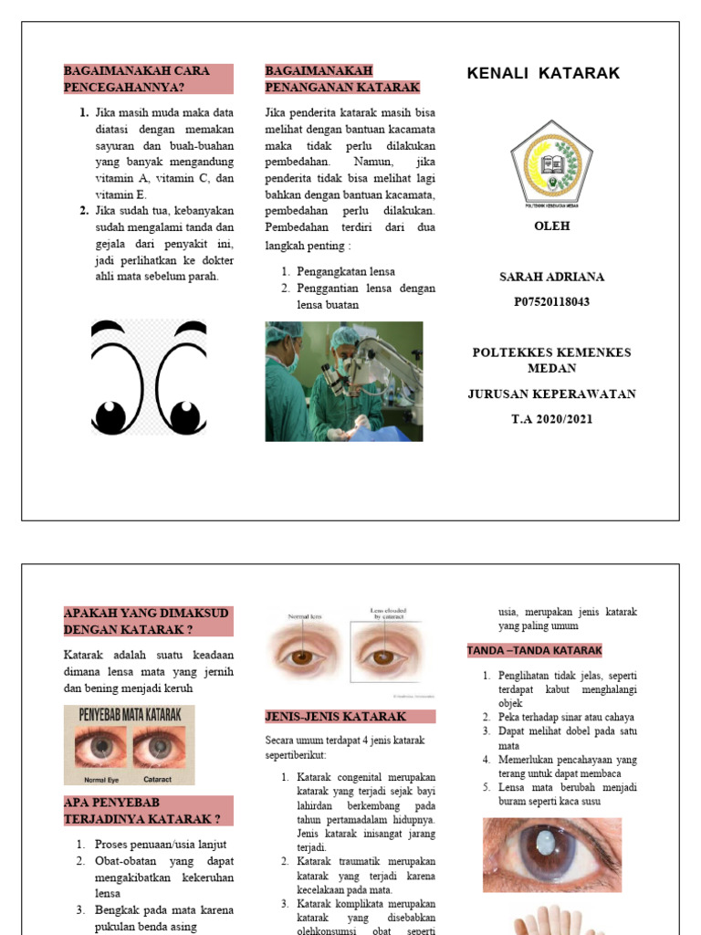 Panduan Lengkap Katarak | PDF