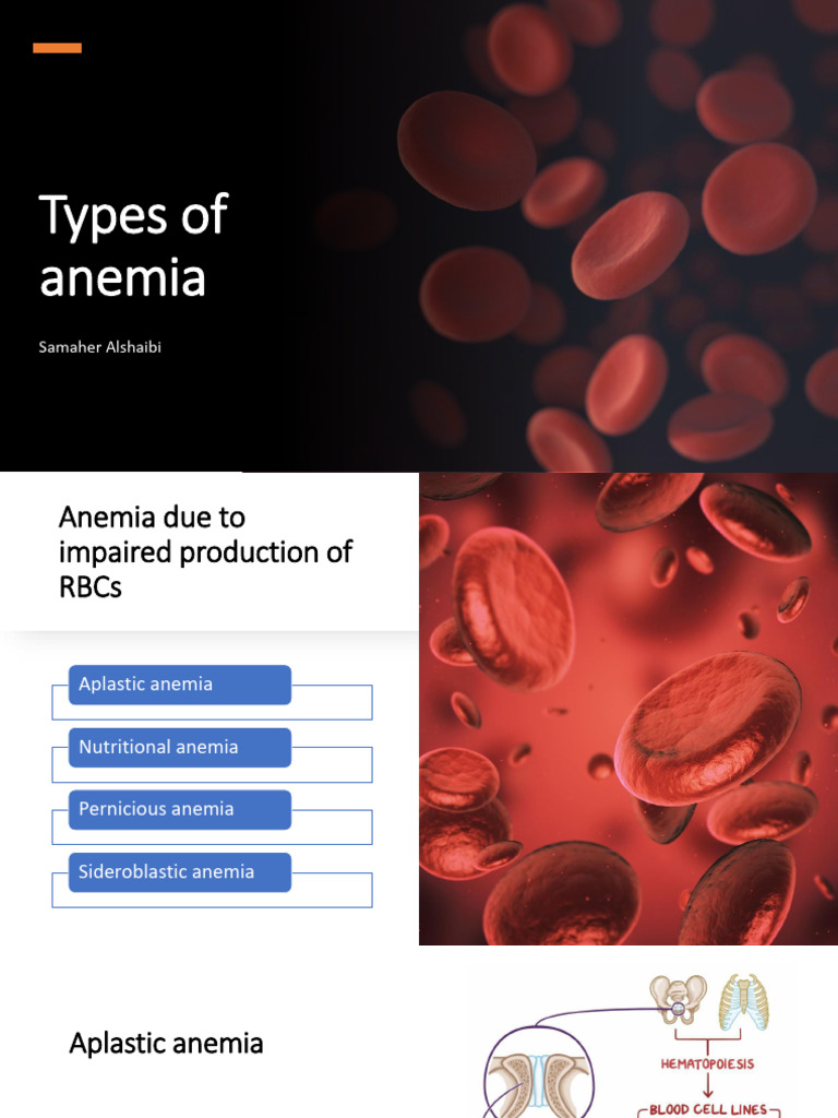 Types of Anemia | PDF | Anemia | Vitamin B12