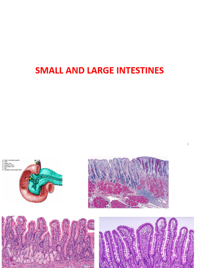 Small and Large Intestine | PDF | Ulcerative Colitis | Crohn's Disease