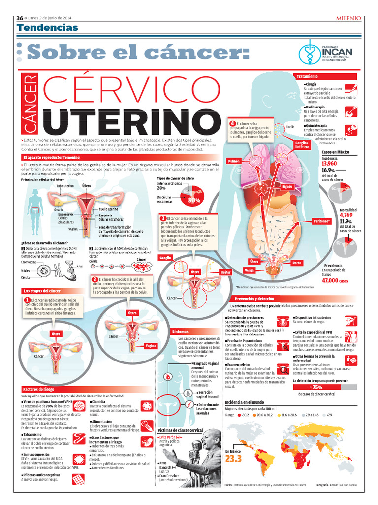 Cancer Cervicouterino | PDF