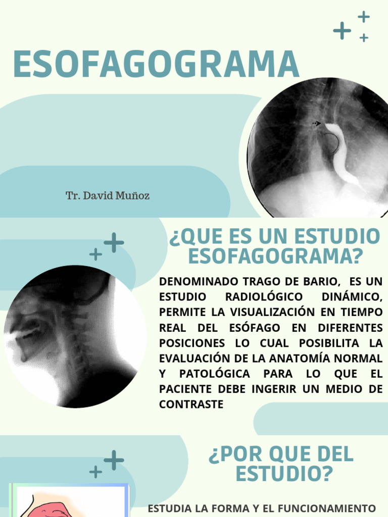 ESOFAGOGRAMA | PDF | Hogar y jardín