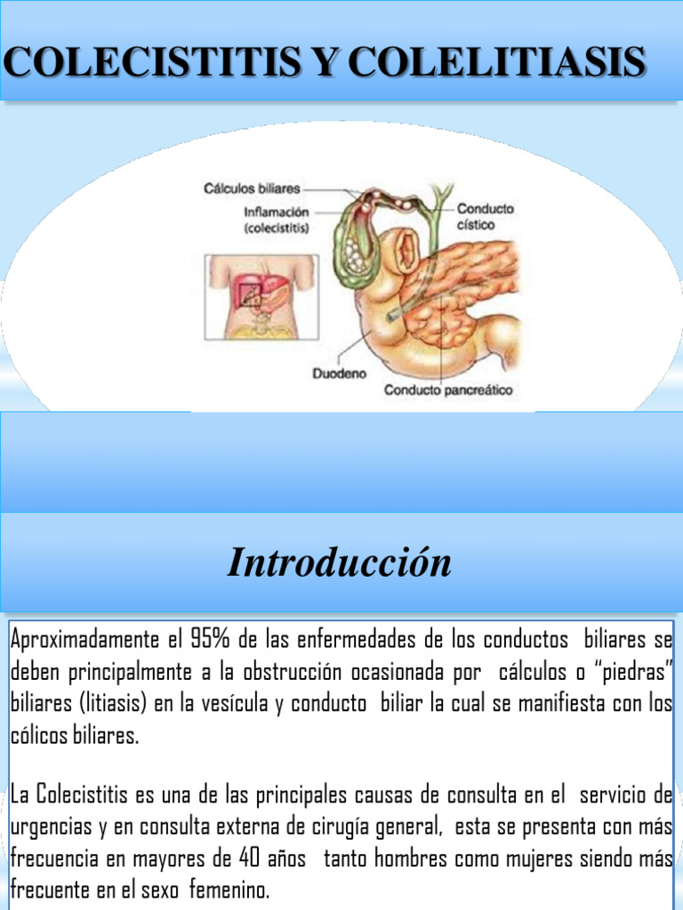 COLECISTITIS Y COLELITIASIS | PDF | Vesícula biliar | Bilis