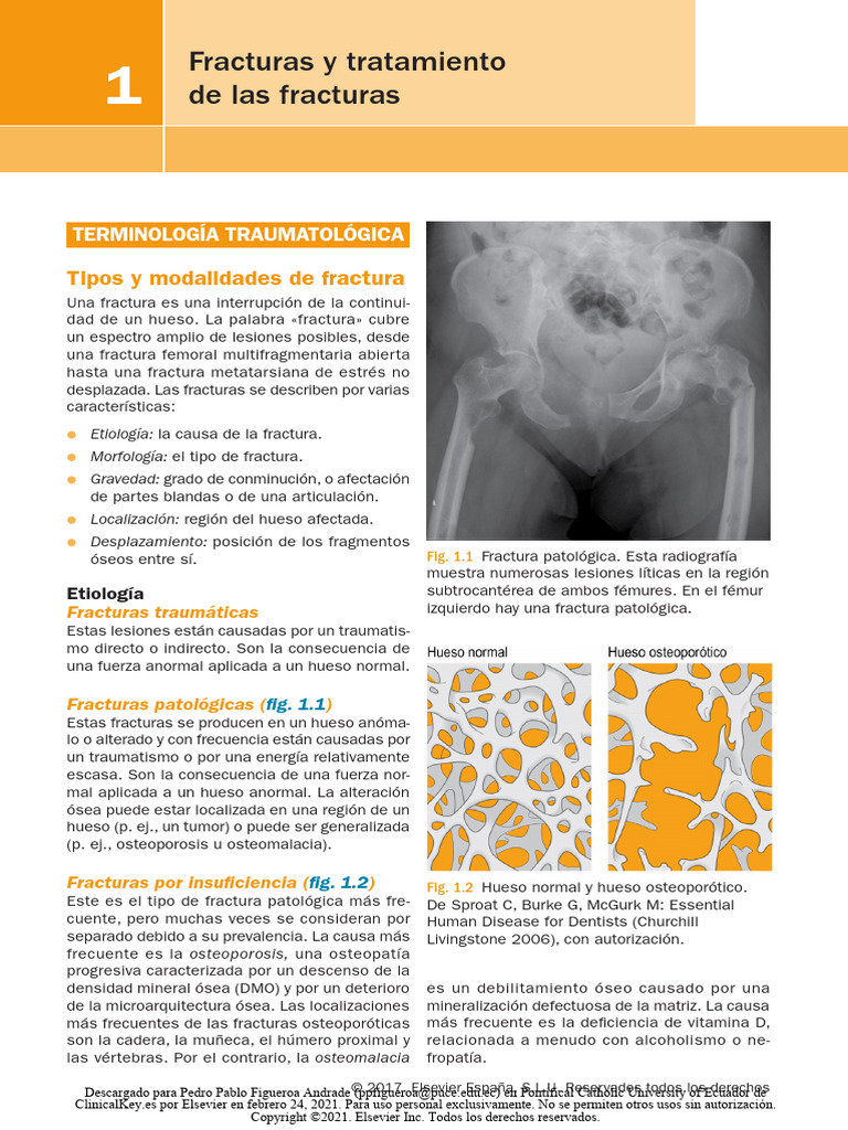 1 Fracturas Y Tto Fracturas Pdf