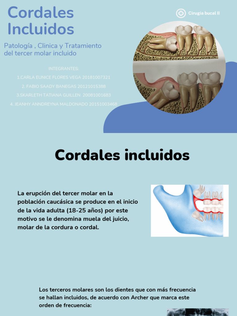 Cordales Incluidos Patologia Clinica y Tratamiento Del Tercer Molar ...