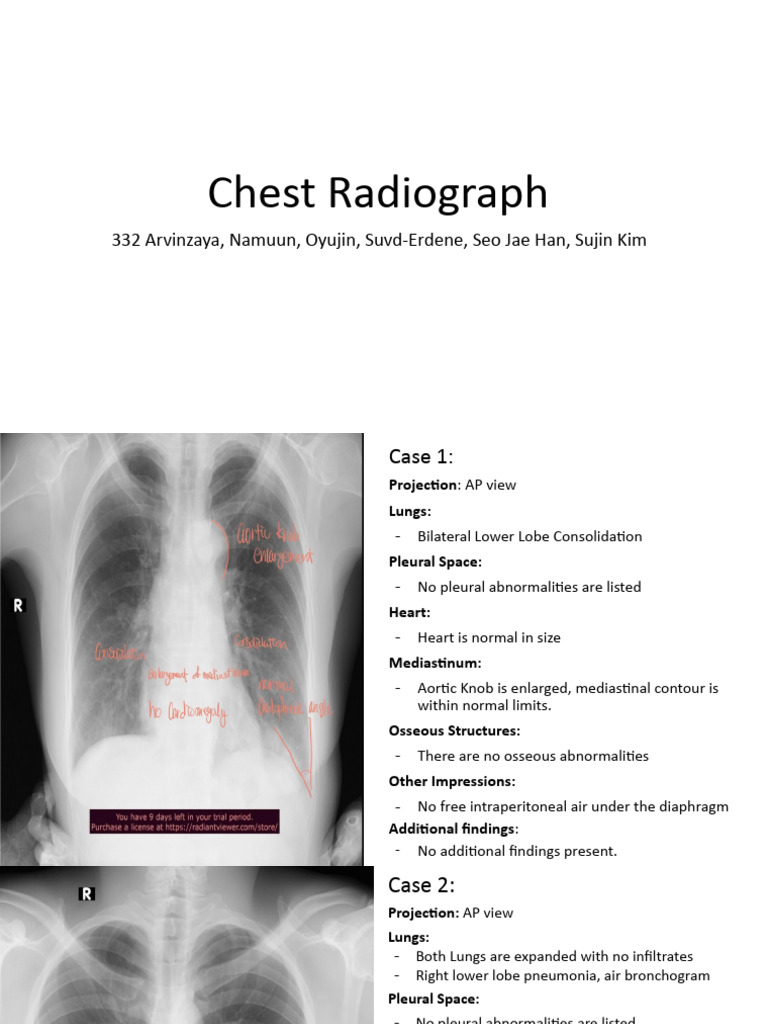 Radiology HW | PDF | Lung | Respiratory Diseases