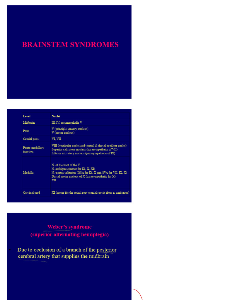 08 Brainstem Syndormes | PDF