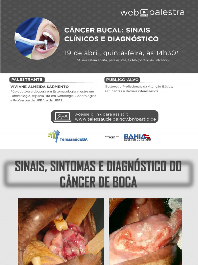 19 04 Sinais Sintomas e Diagn Do Cancer de Boca | PDF | Carcinoma | Câncer