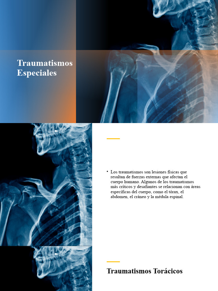 Guía de Traumatismos: Evaluación y Soporte | PDF | Lesión | Tórax