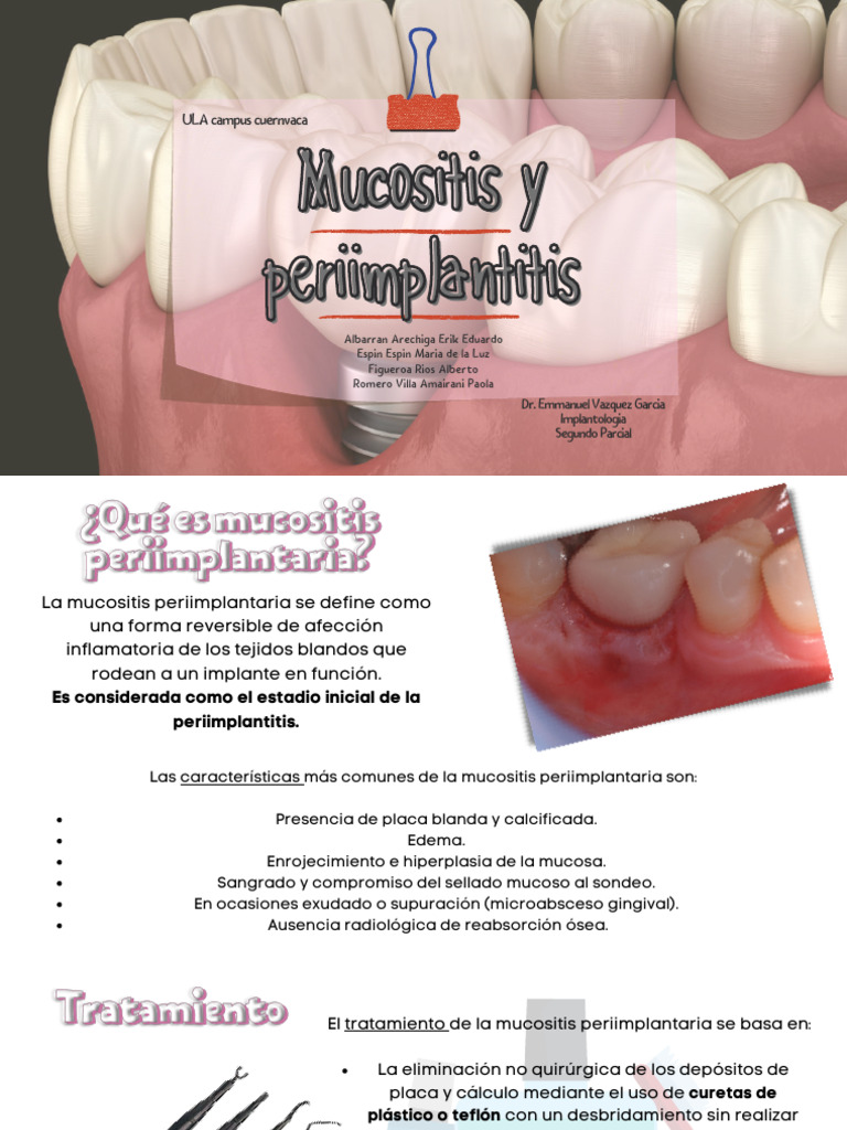 Mucositis y Periimplantitis | PDF