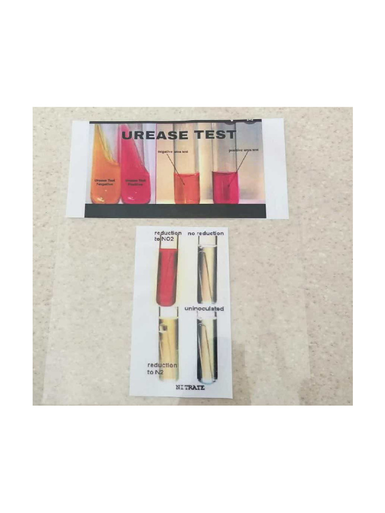 Test + Kits Microbiology University | PDF