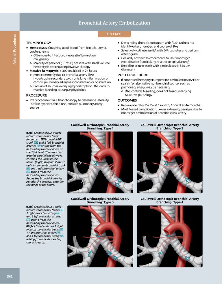Bronchial Artery Embolization | PDF