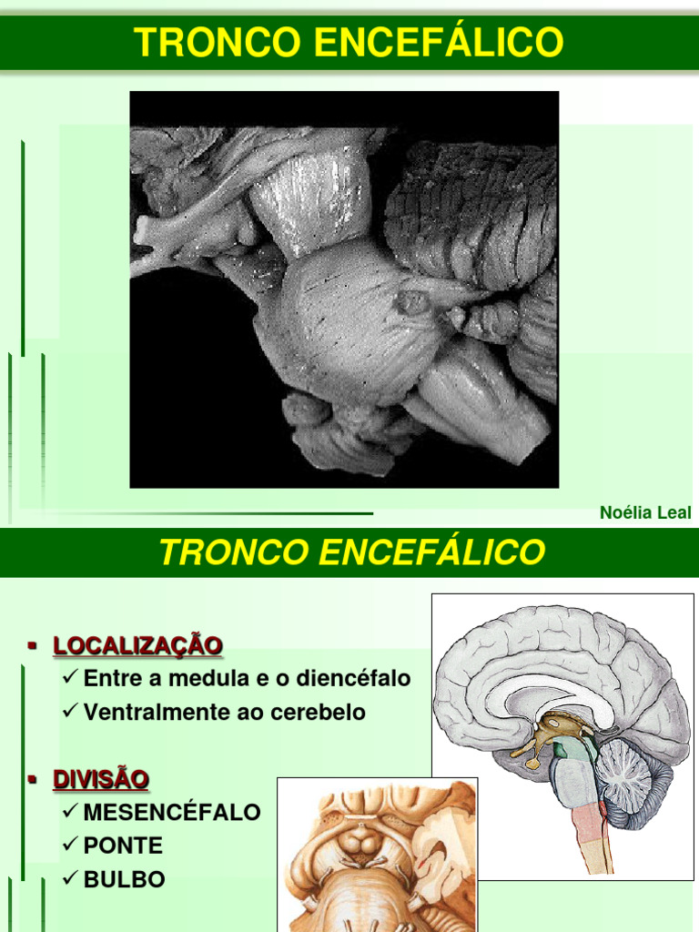 Aula 04 - Tronco Encefalico | PDF | Cérebro | Neuroanatomia