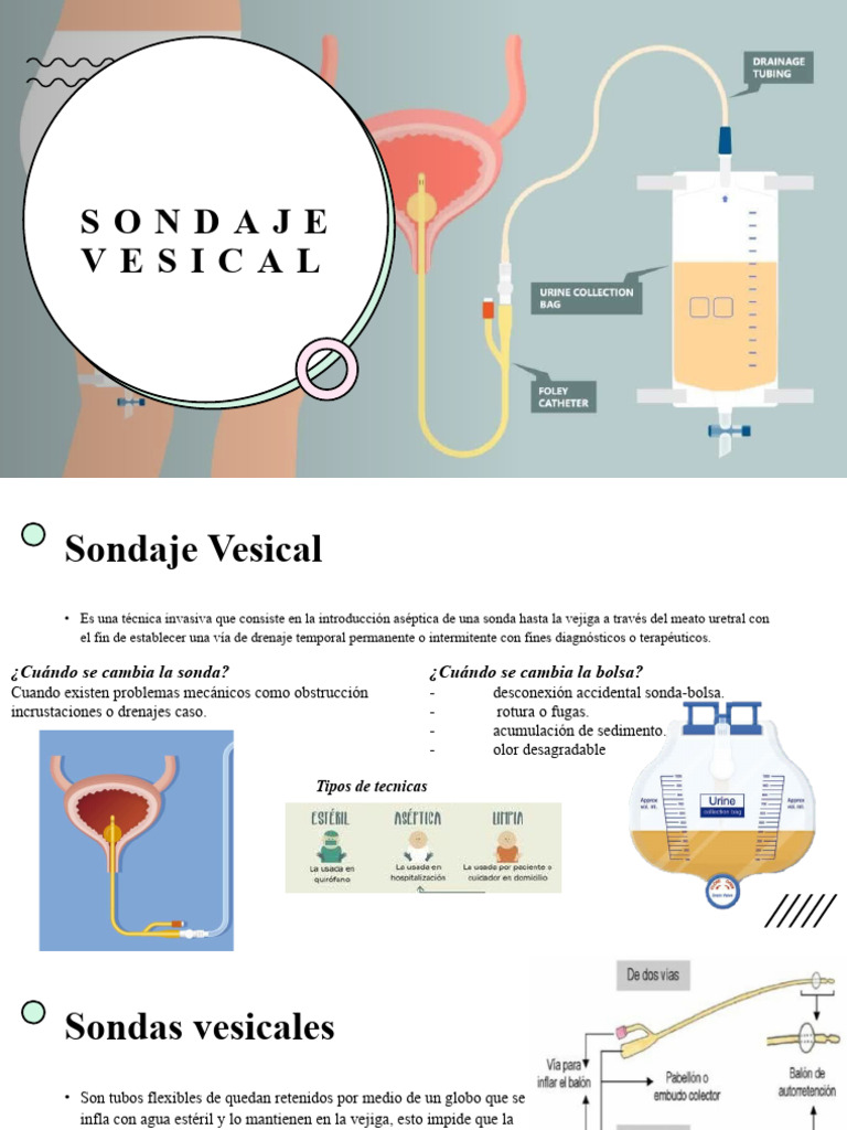 Sondaje | Descargar gratis PDF | Sistema urinario | Medicina