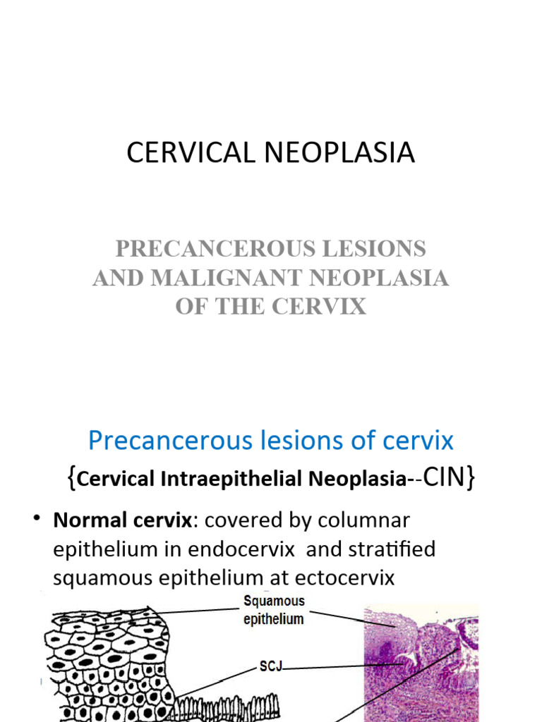 10 Cervical Neoplasia | PDF | Human Reproduction | Public Health