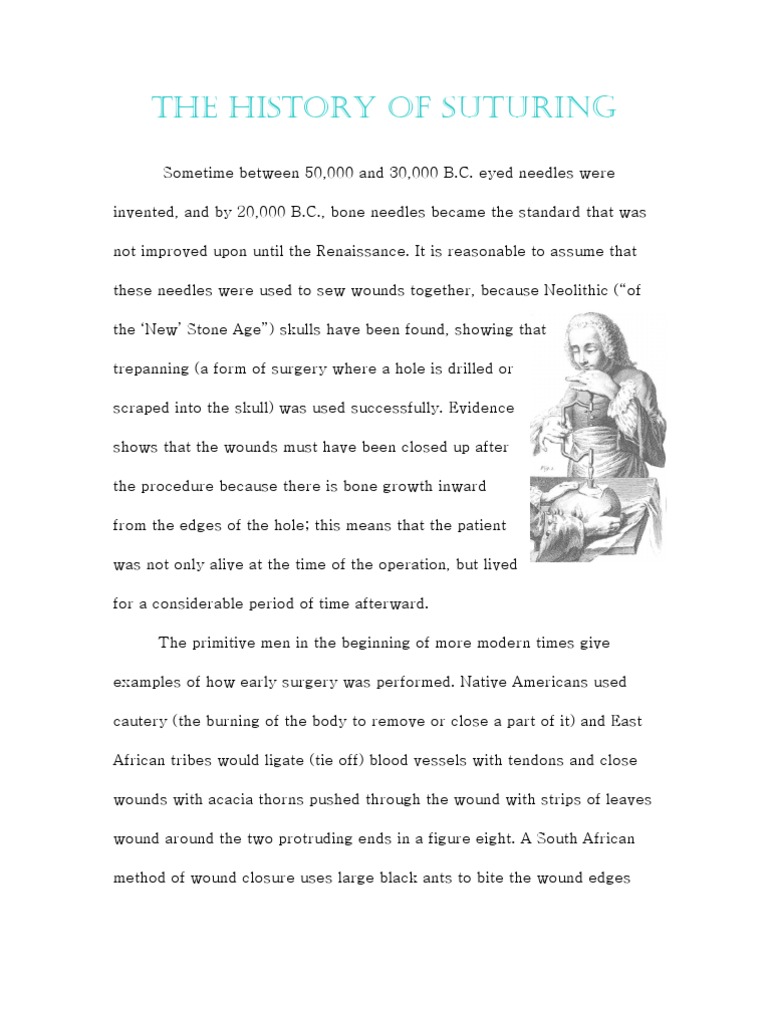 Evolution of Surgical Sutures | PDF | Surgical Suture | Surgery