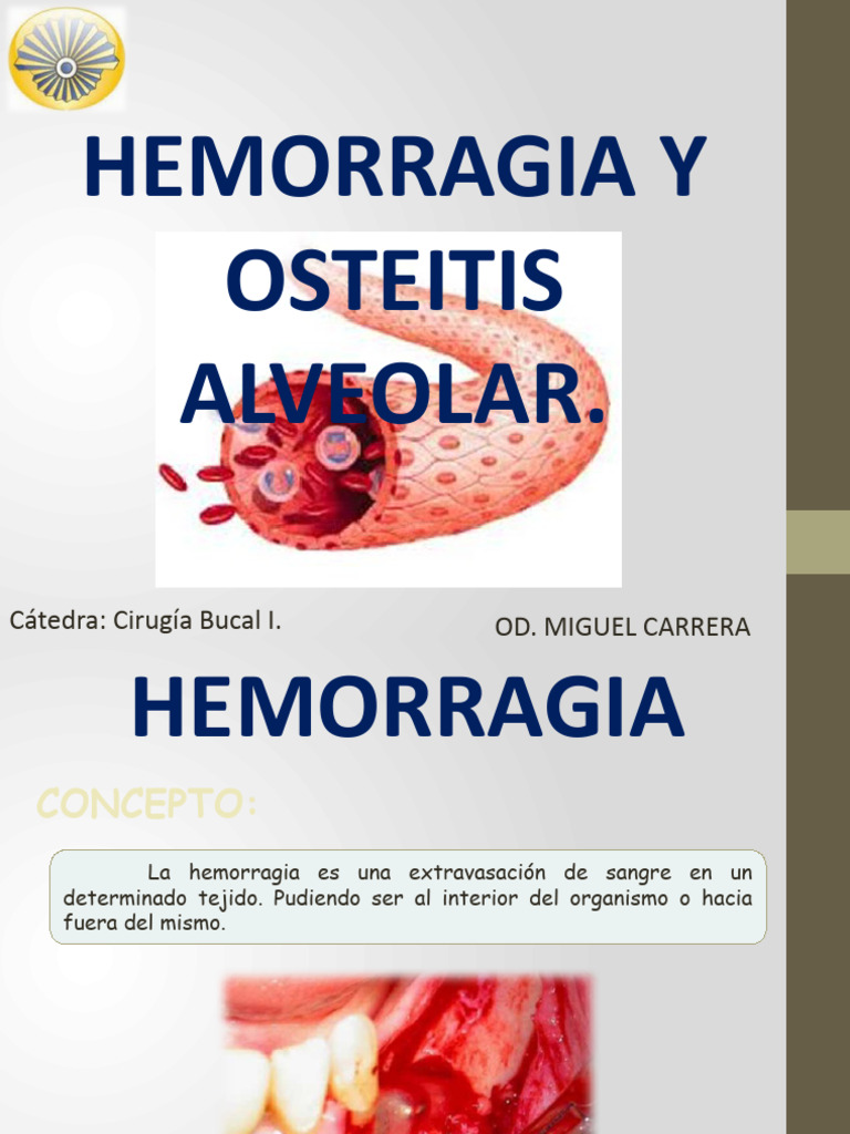 Hemorragia y Osteitis Alveolar. | PDF | Coagulación | Hemofilia