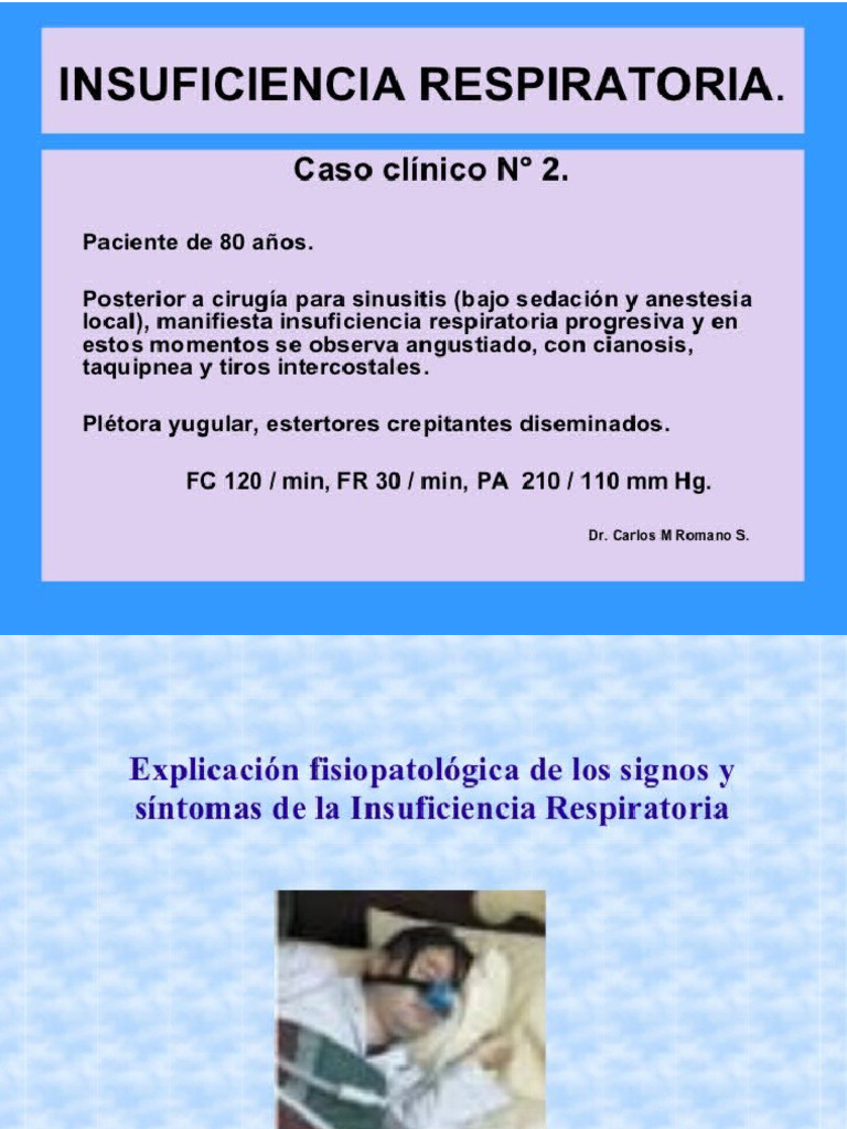 Insuficiencia Respiratoria Aguda | PDF