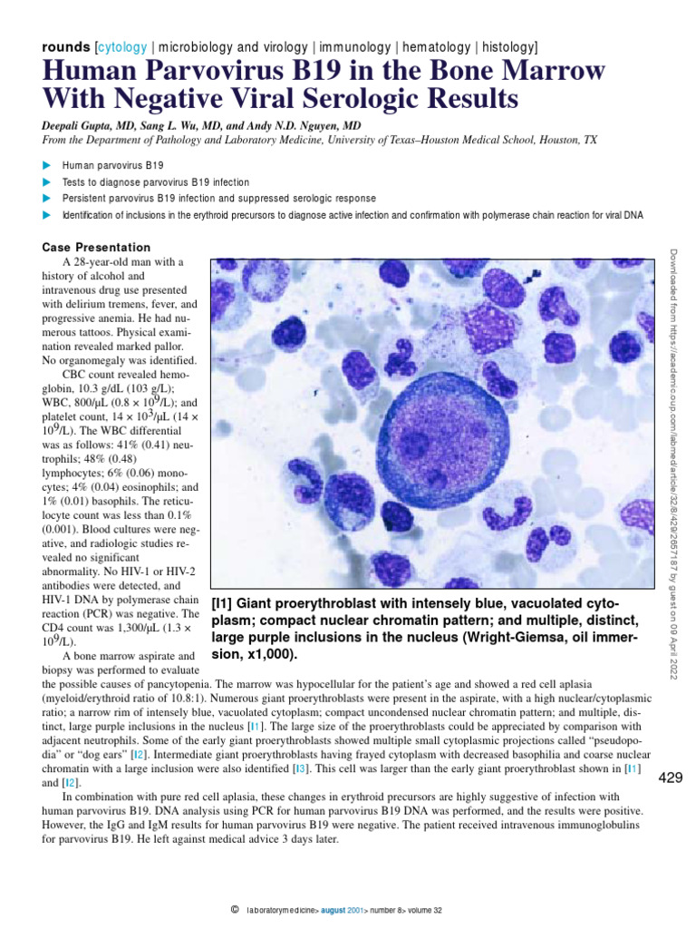 Human Parvovirus B19 in The Bone Marrow | Download Free PDF | Antibody ...