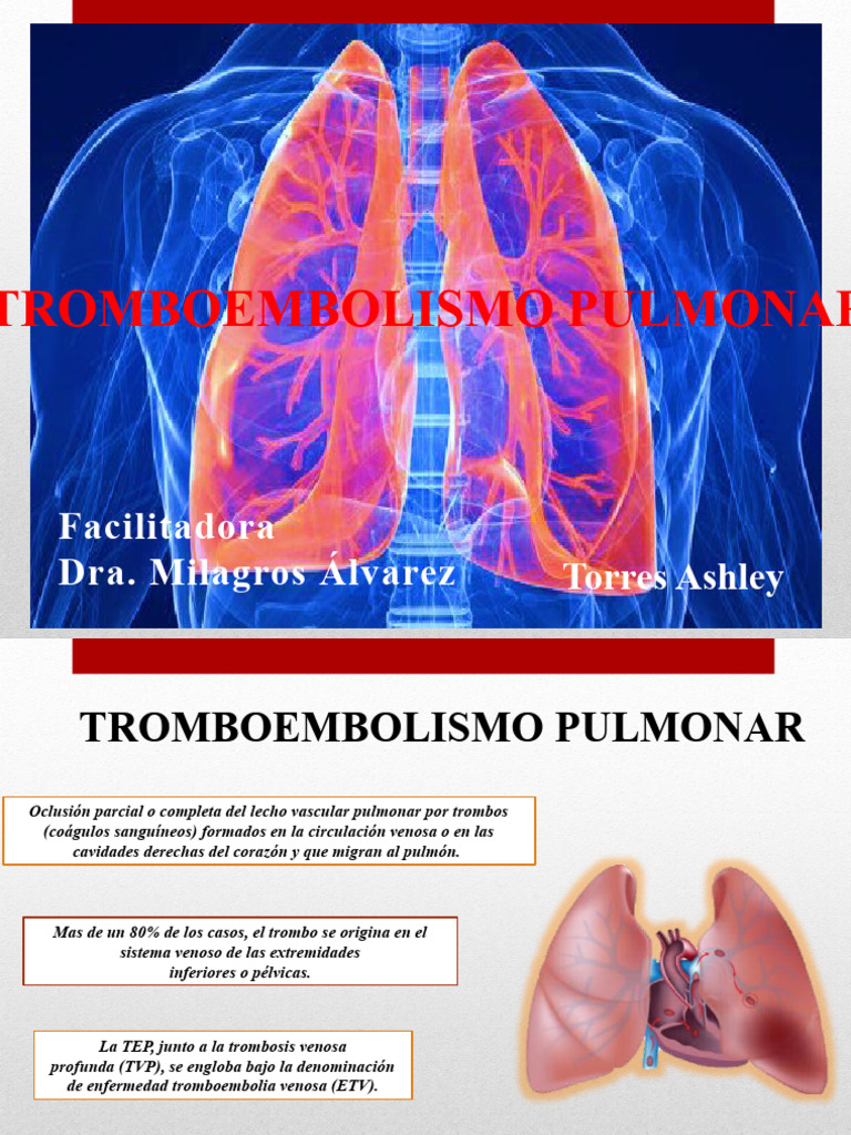 Tromboembolismo Pulmonar | PDF | Trombo | Epidemiología