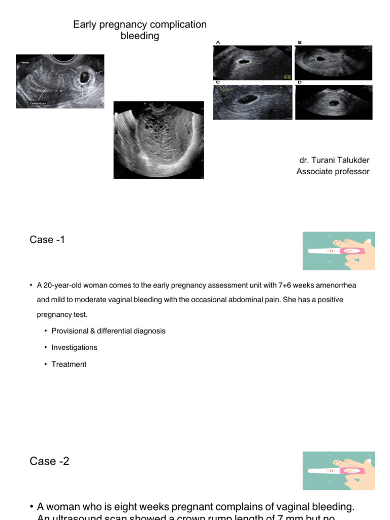 Clinical Approach For Early Pregnancy Complication | PDF