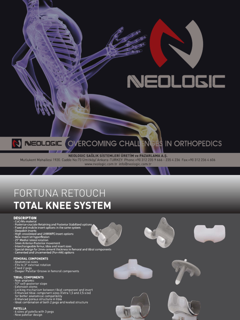 Fortuna Knee Prosthesis Components | PDF | Musculoskeletal System ...